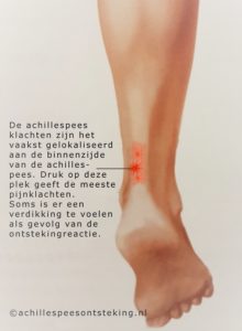 diagnose - Achillespeesblessure - achiilespeesontsteking ...